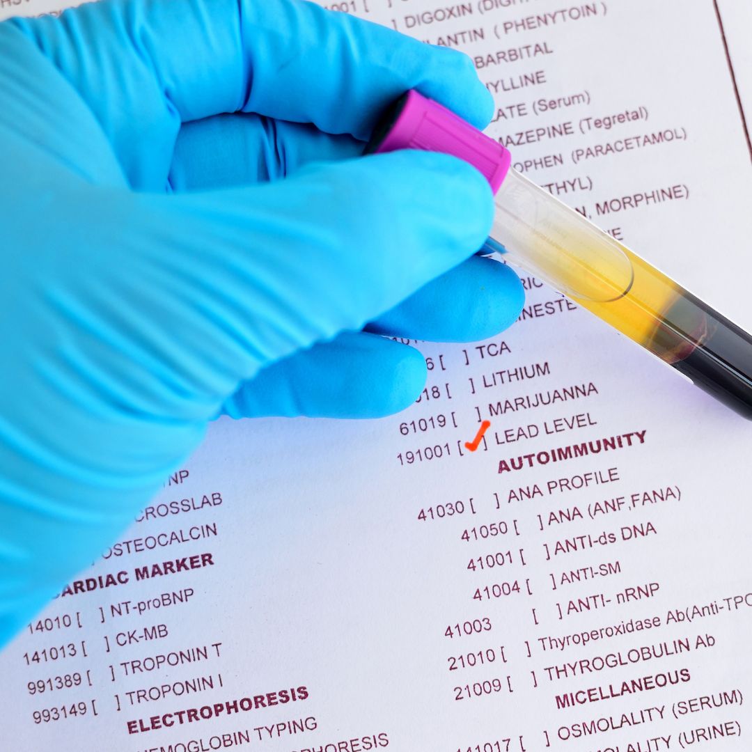 HUD Elevated Blood Lead Level Threshold Revision